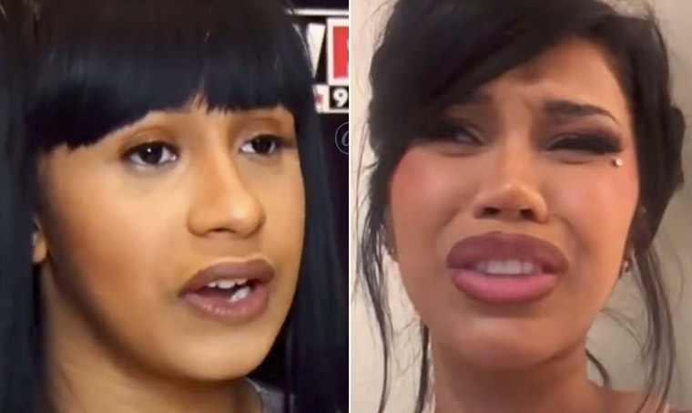 Cardi B Fans Shocked by Her Latest Round of Plastic Surgery – Sandra Rose